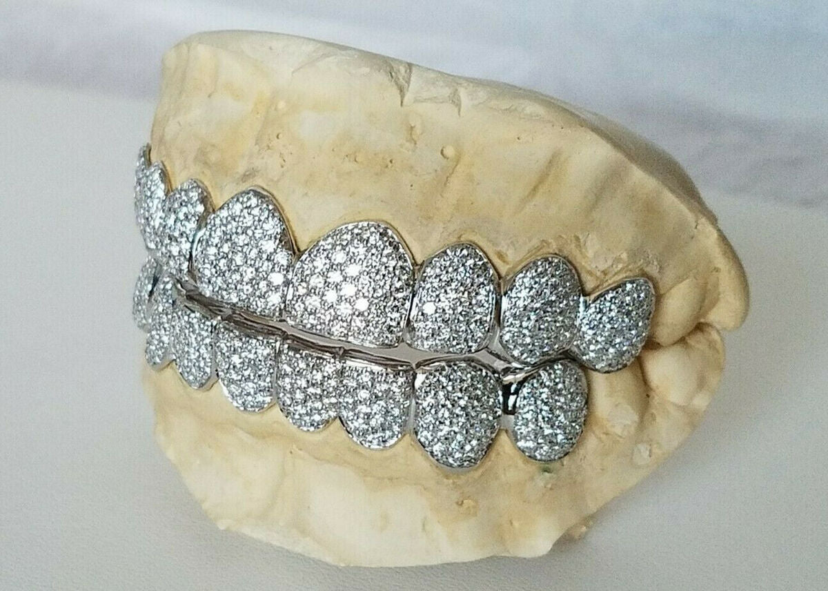 Grillz en diamants 8 dents Haut et Bas – Bijouterie Jamil